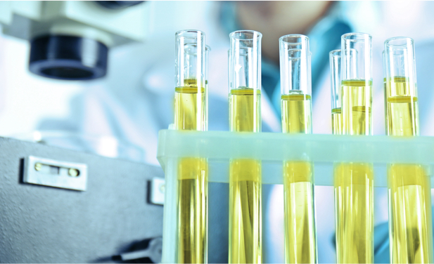 Testing Options for PH1 (Primary Hyperoxaluria Type 1) | Behind the Stone